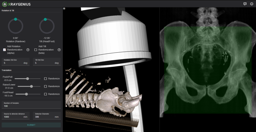 Introducing a New Tool for Synthetic X-ray Image Generation: Sign Up ...