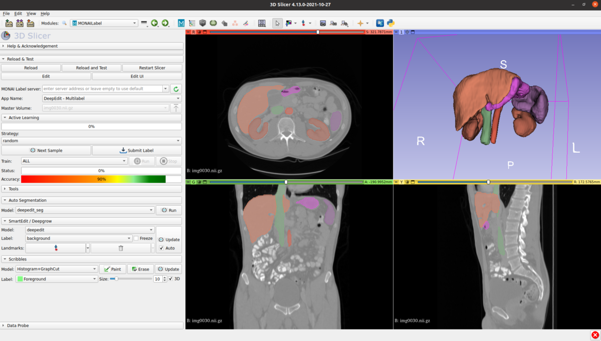Privacy-Preserving and Energy-Efficient MONAI Medical Image Annotation ...