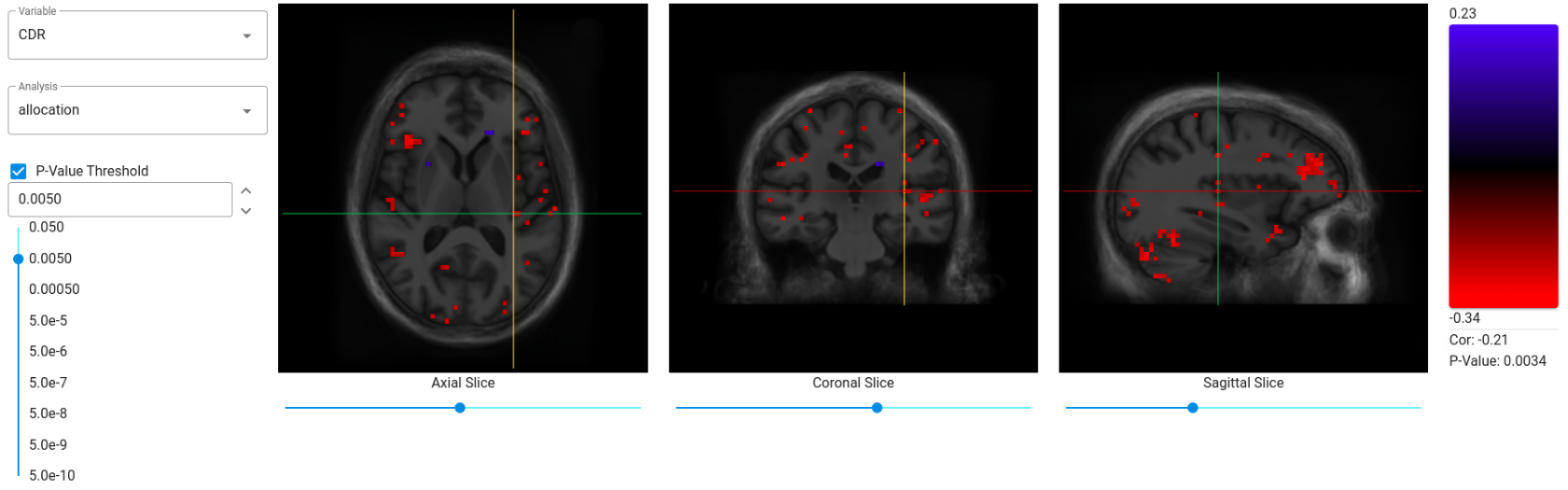 Introducing Web-OTM (Optimal Transport Morphometry): A Web-Based ...