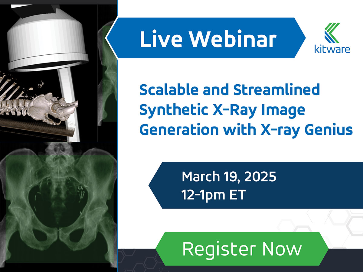 Free Webinar: Scalable and Streamlined Synthetic X-Ray Image Generation with X-ray Genius