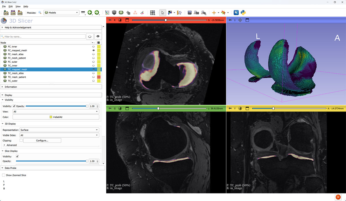 Orchestrating Medical Imaging Workflows: A Dagster-Based Approach for ...