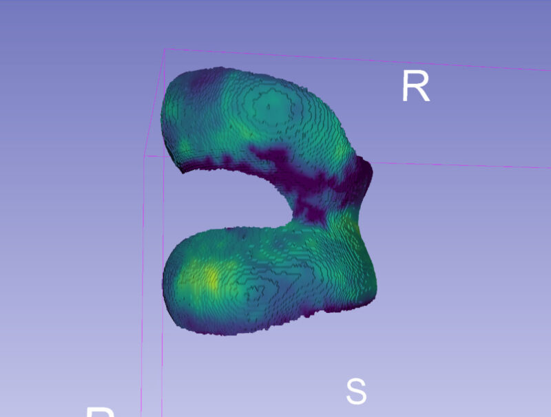 Orchestrating Medical Imaging Workflows: A Dagster-Based Approach for ...