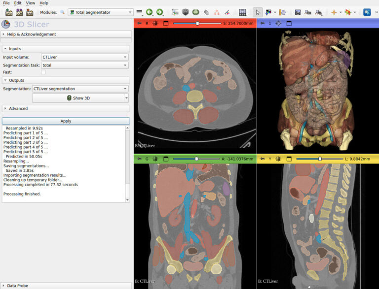 How to Leverage 3D Slicer for Medical Imaging Research & Product ...