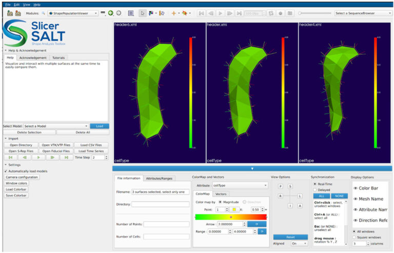 How to Leverage 3D Slicer for Medical Imaging Research & Product Development