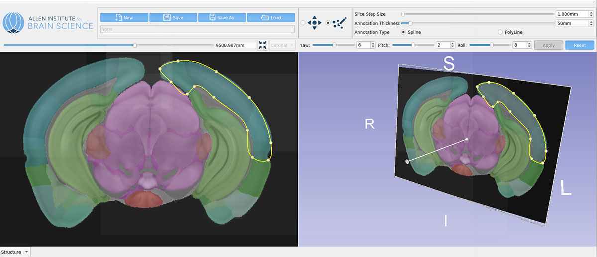 How to Leverage 3D Slicer for Medical Imaging Research & Product Development