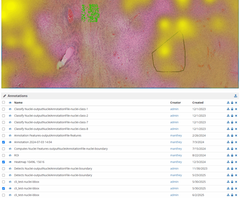 Improved Annotation Management in HistomicsTK