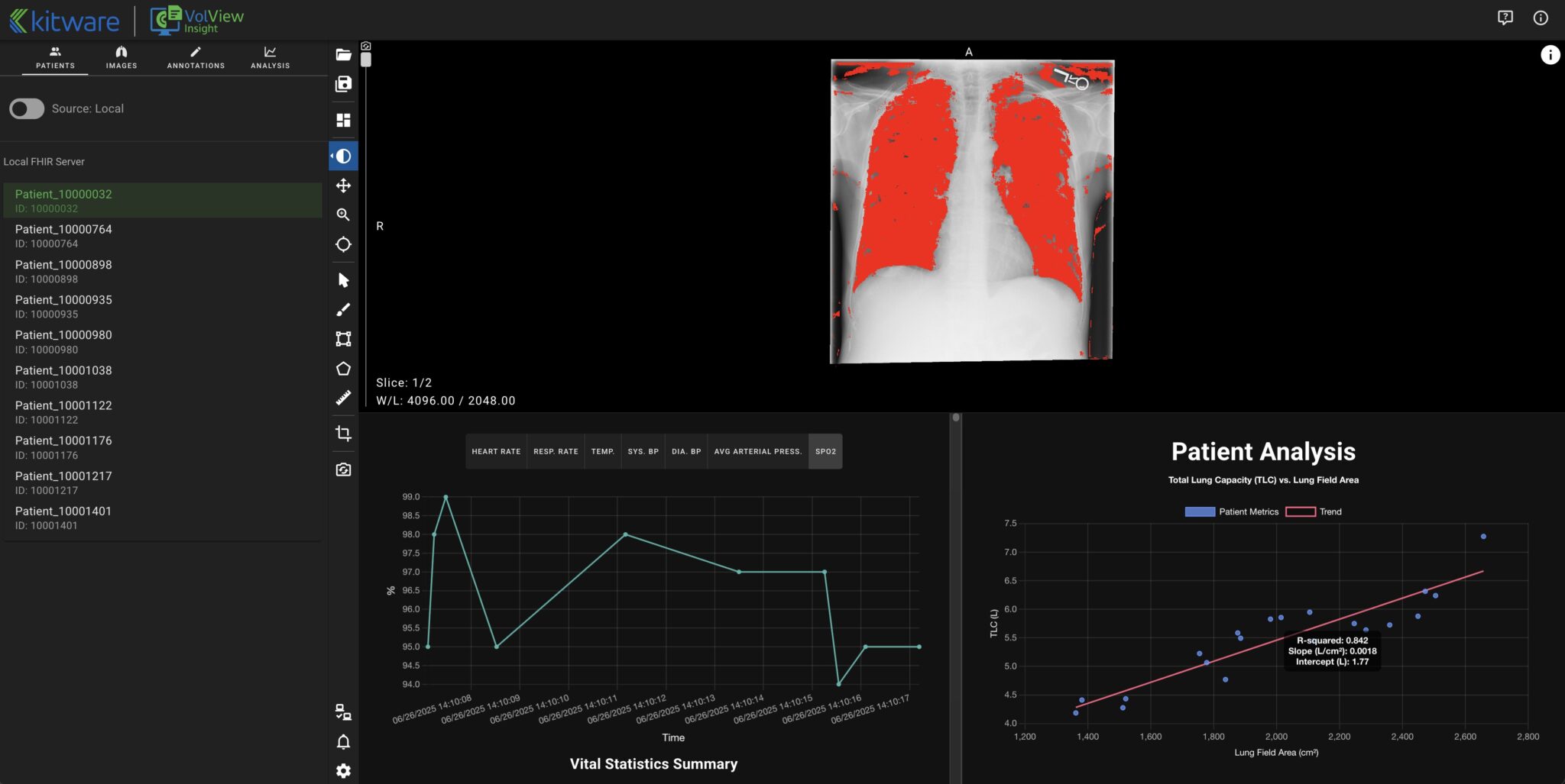 VolView Insight: A Seamful Integration for Clinical AI