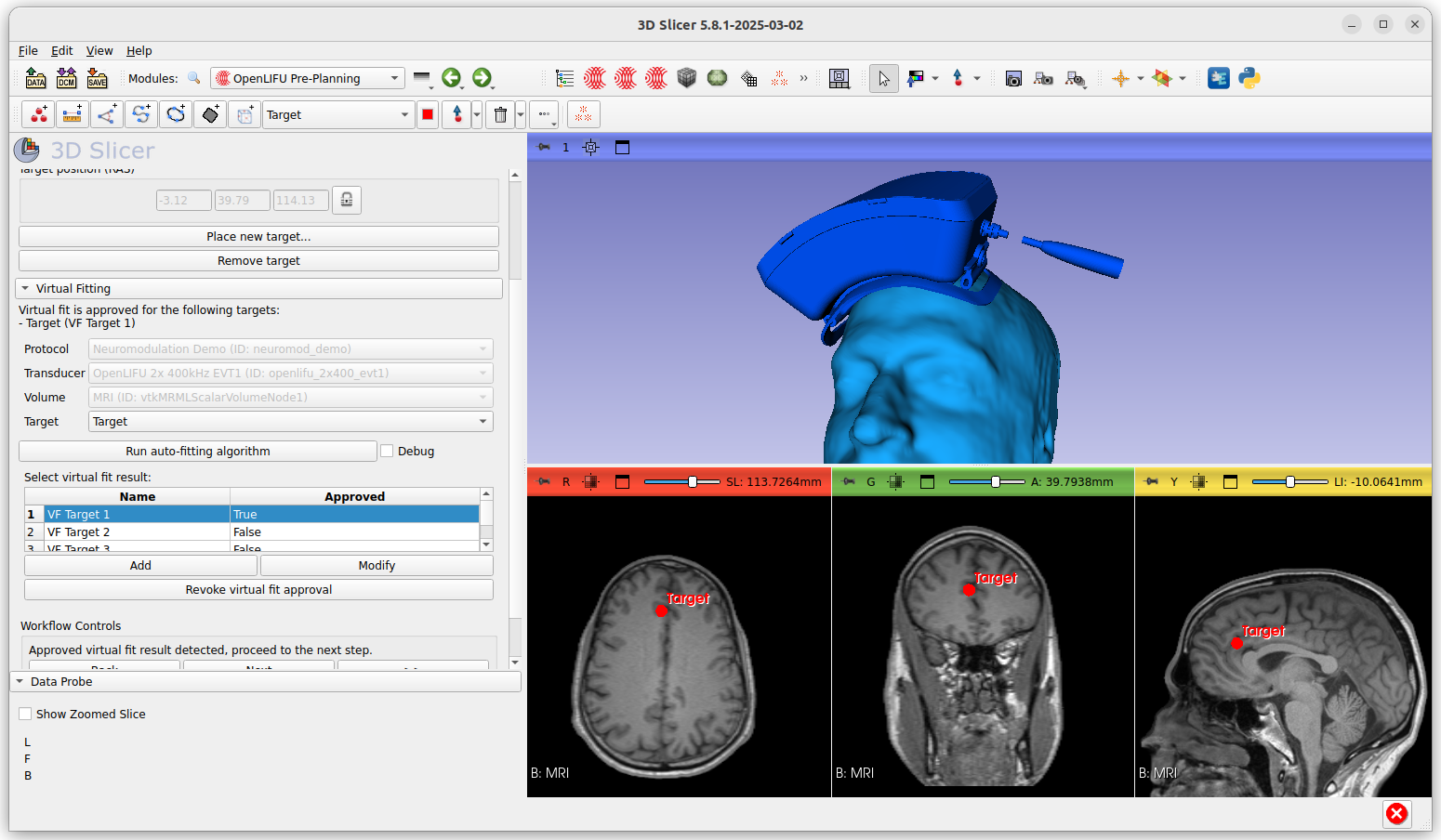 OpenLIFU: Accelerating Focused Ultrasound Research with Open Source ...