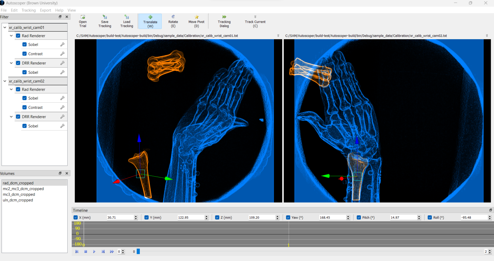 Markerless 3D skeletal and implant tracking with SlicerAutoscoperM